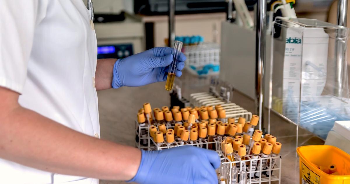 Liberando el potencial de los biomarcadores para el cáncer colorrectal